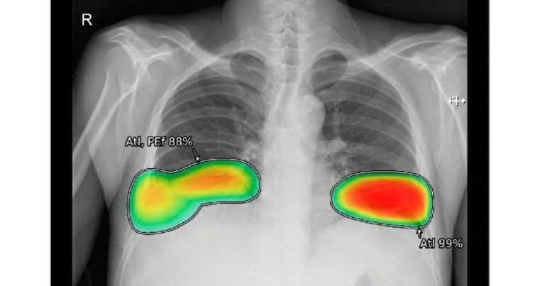 Samsung taps Lunit for AI-powered advanced chest screening - DH Arab