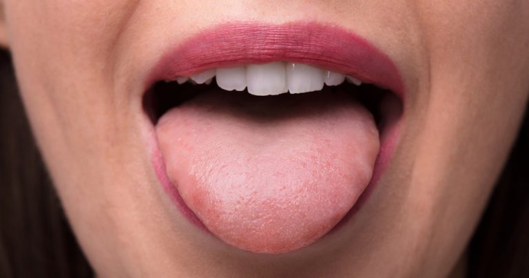 AI system uses tongue color to identify multiple health conditions - DH ...