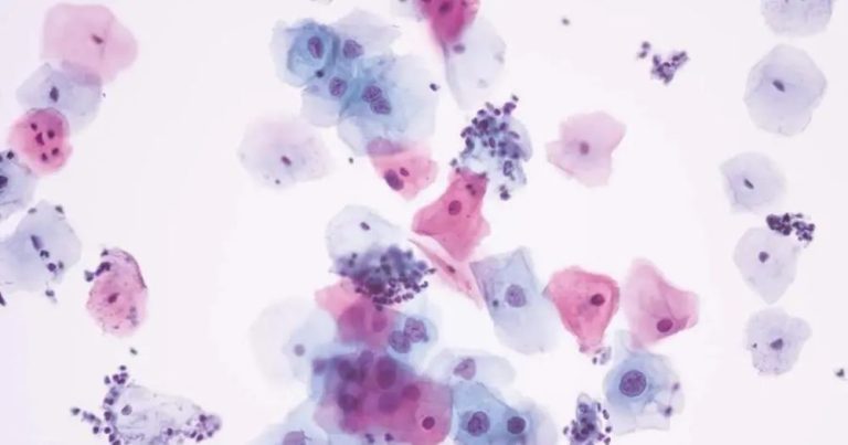 Unilabs Middle East launches region's first AI-powered digital cytology ...